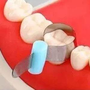 Matrix Bands - available in different sizes and shapes